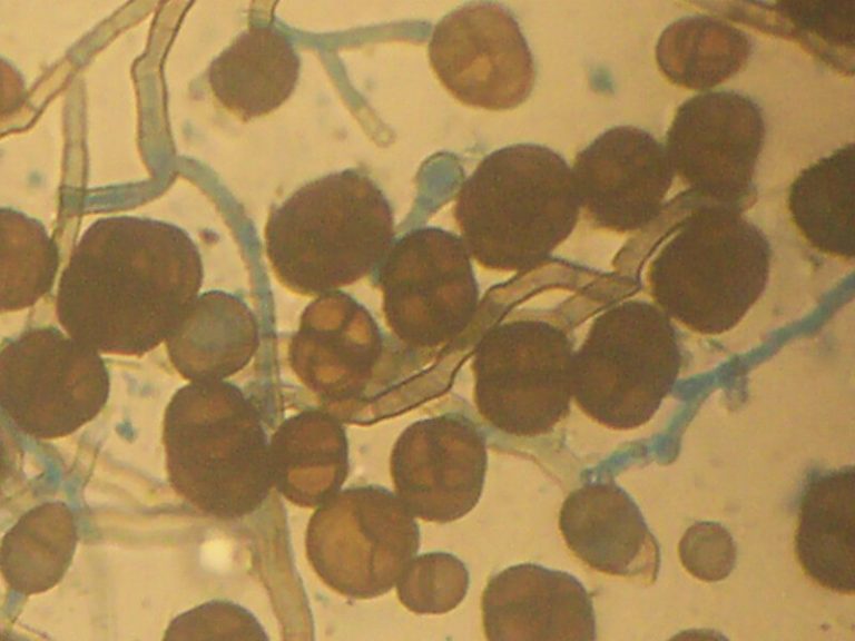 13 Most Common Types of Mold in Homes